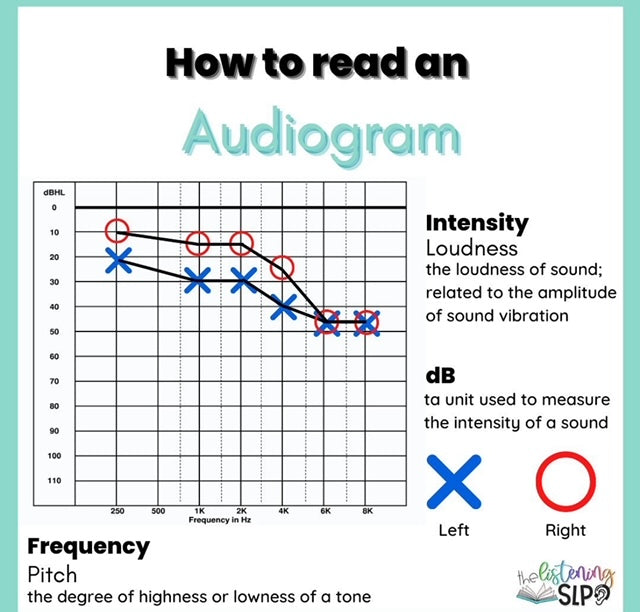 Deciphering Sound: A Guide to Understanding and Reading an Audiogram ...